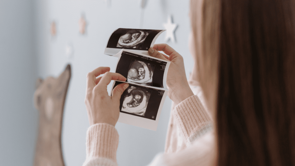 What is Fetal Alcohol Syndrome (FAS) in Adults?